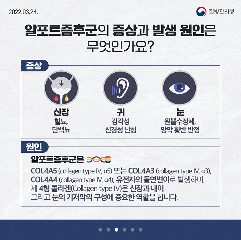 신장을 망가뜨리는 희귀질환 알포트증후군 이달의건강소식 알림·자료 질병관리청